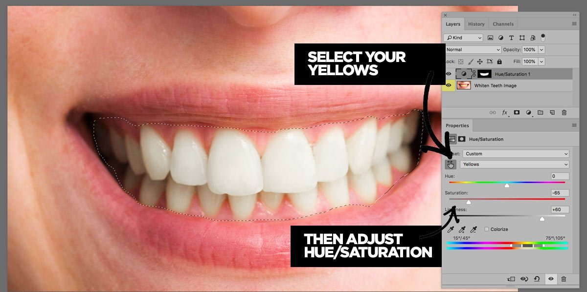 How to Whiten Teeth in Photoshop (Tutorial) (2026 UPDATED)